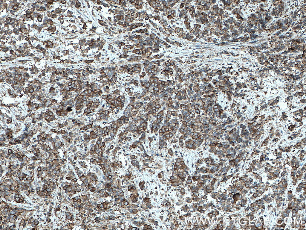 ATP1A3 (middle) antibody (28030-1-AP) | Proteintech