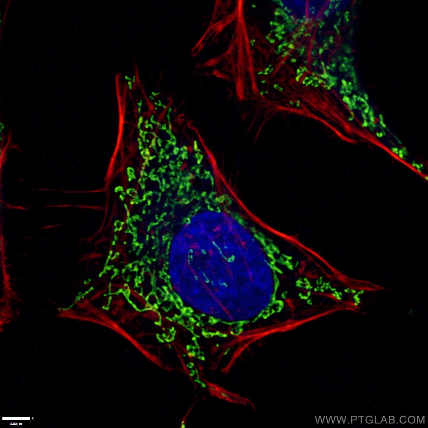 ATP5O antibody (66696-1-Ig) | Proteintech