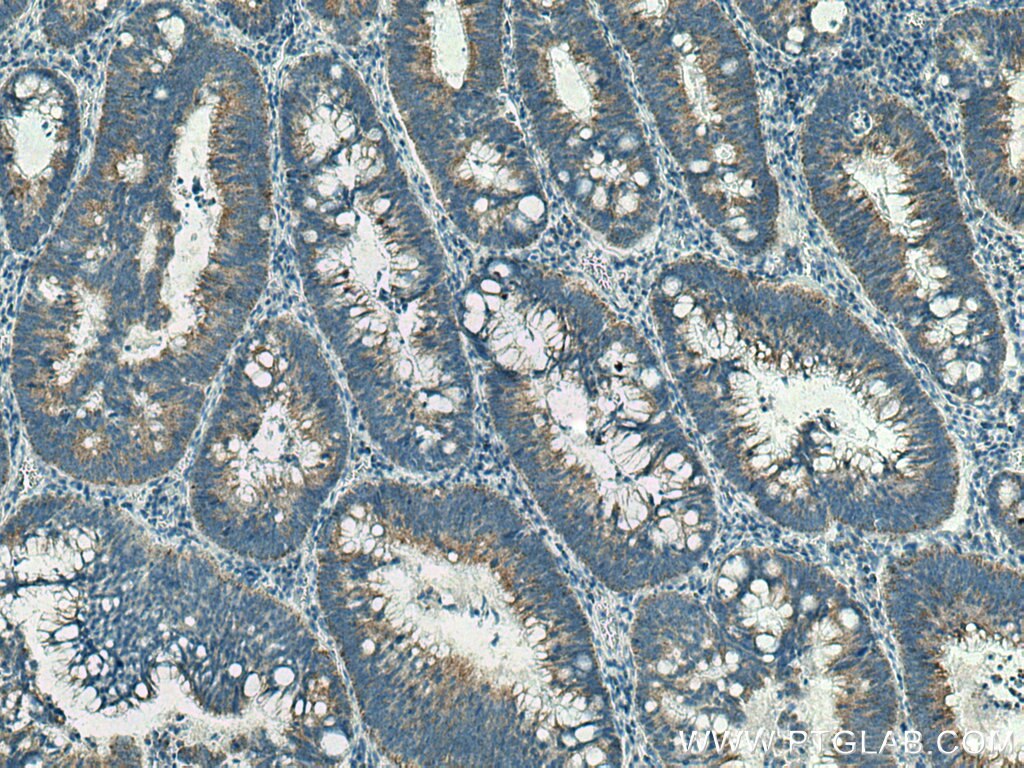 ATP5O Antibody 66696-1-Ig | Proteintech
