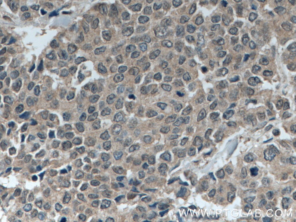 ATP7B-Specific antibody (19786-1-AP) | Proteintech