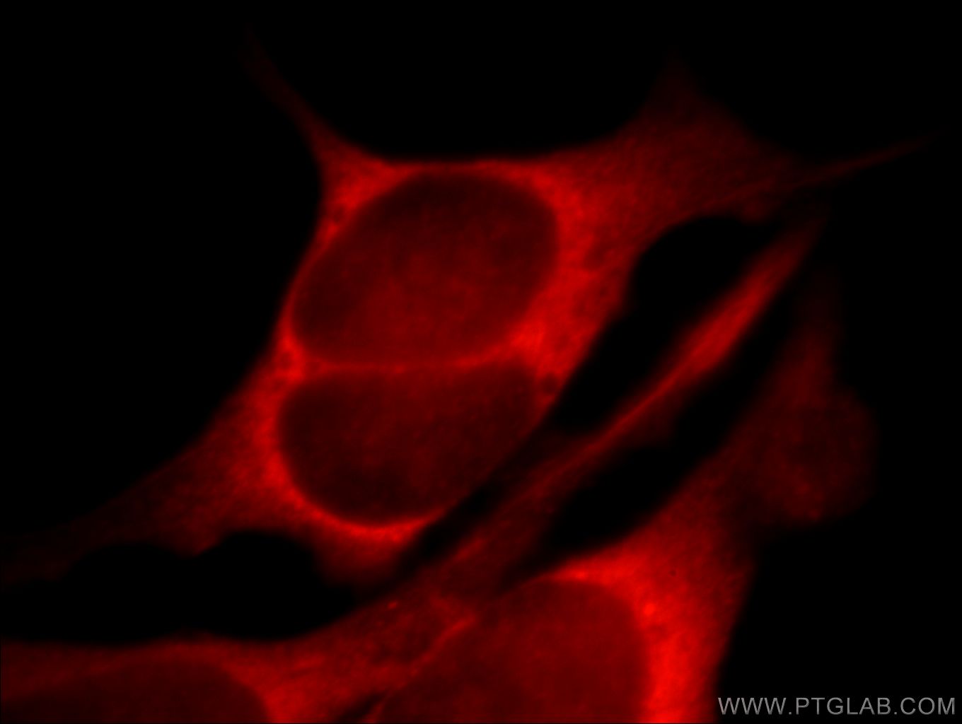 Ataxin 2 Antibody 21776-1-AP | Proteintech