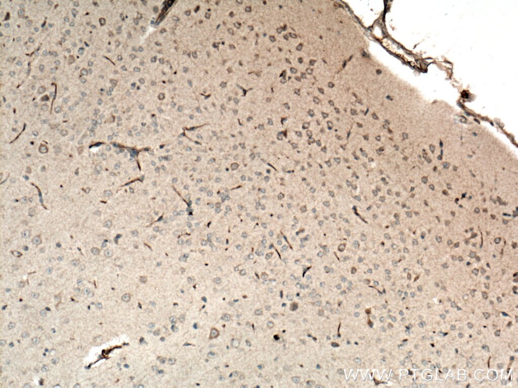 CD57 antibody (19401-1-AP) | Proteintech