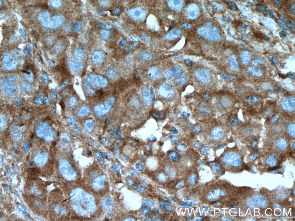 B4GALT3 antibody (11041-1-AP) | Proteintech
