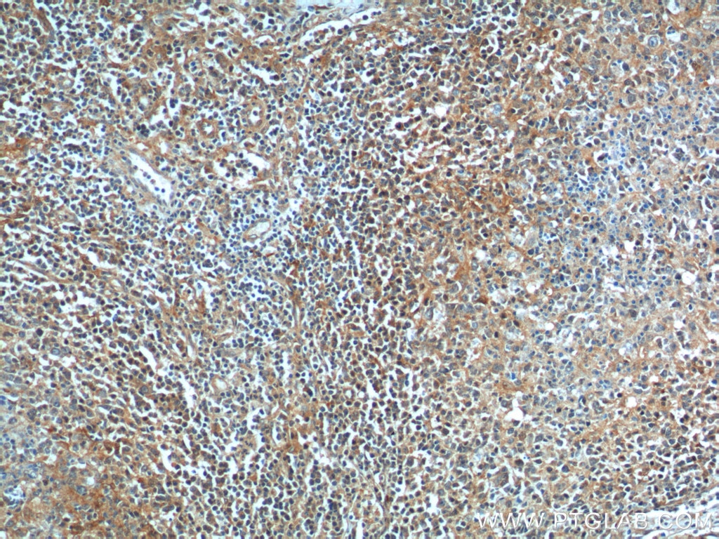 BAD antibody (10435-1-AP) | Proteintech