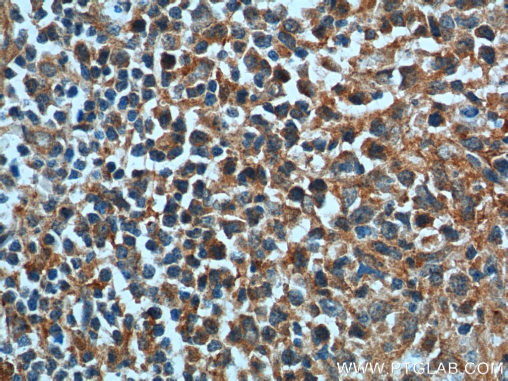 BAD antibody (10435-1-AP) | Proteintech