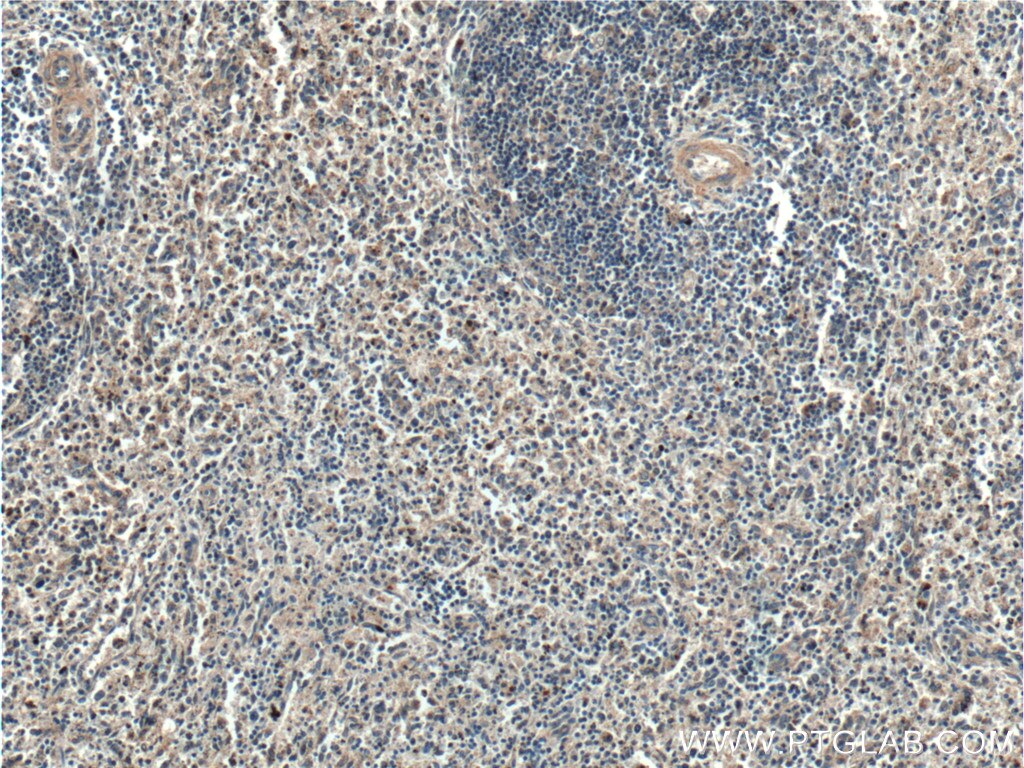 BAMBI Antibody 16100-1-AP | Proteintech