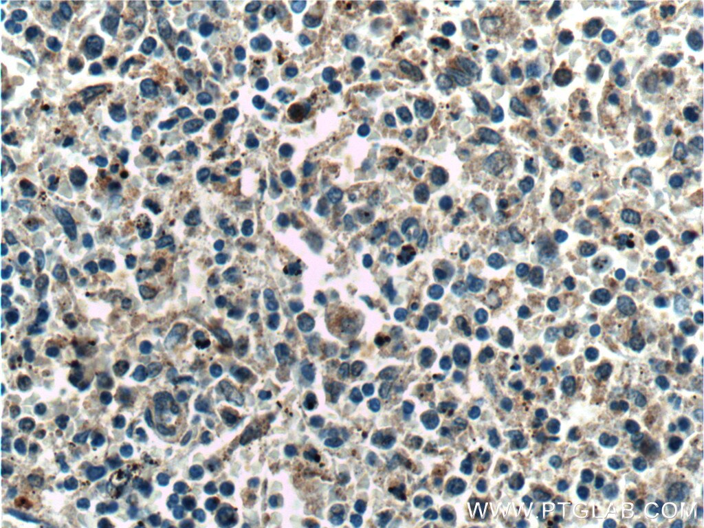 BAMBI Antibody 16100-1-AP | Proteintech