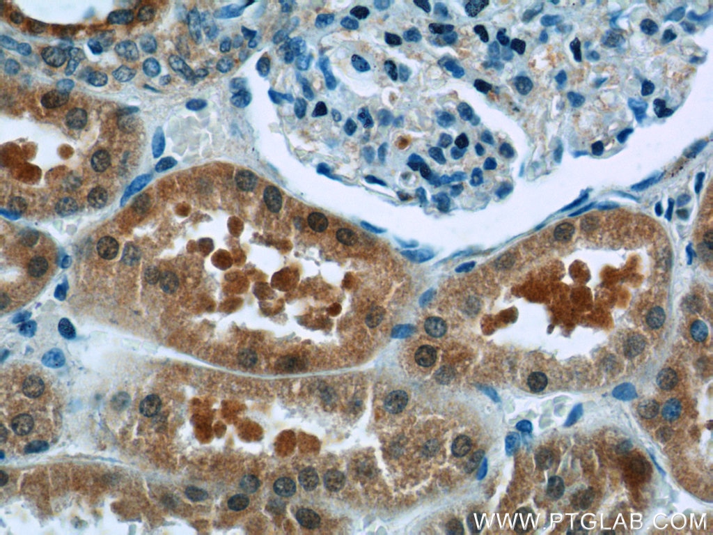 BAX Antibody 23931-1-AP | Proteintech