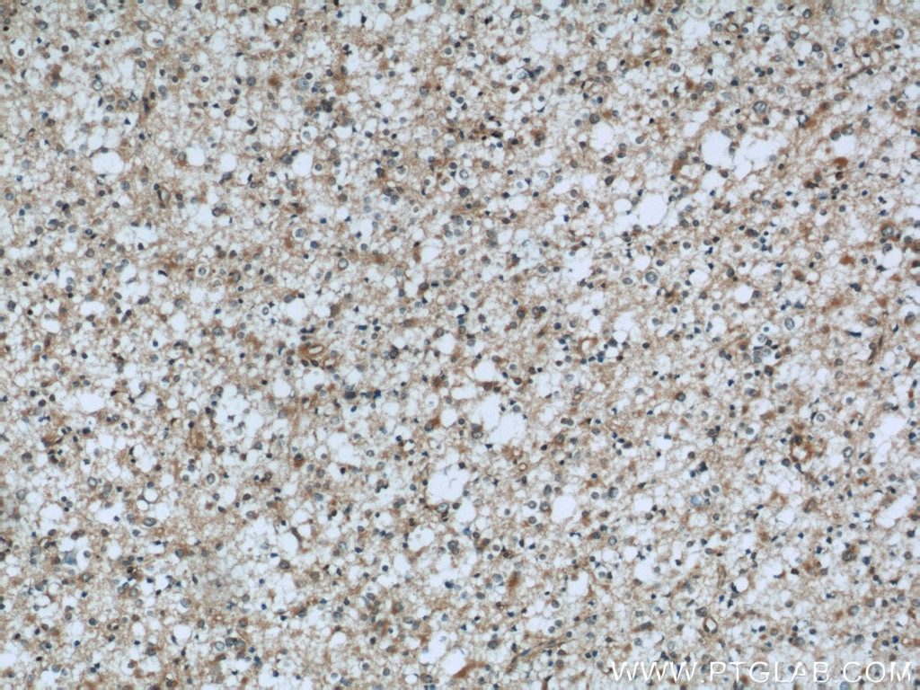 BAX Antibody 50599-2-Ig | Proteintech