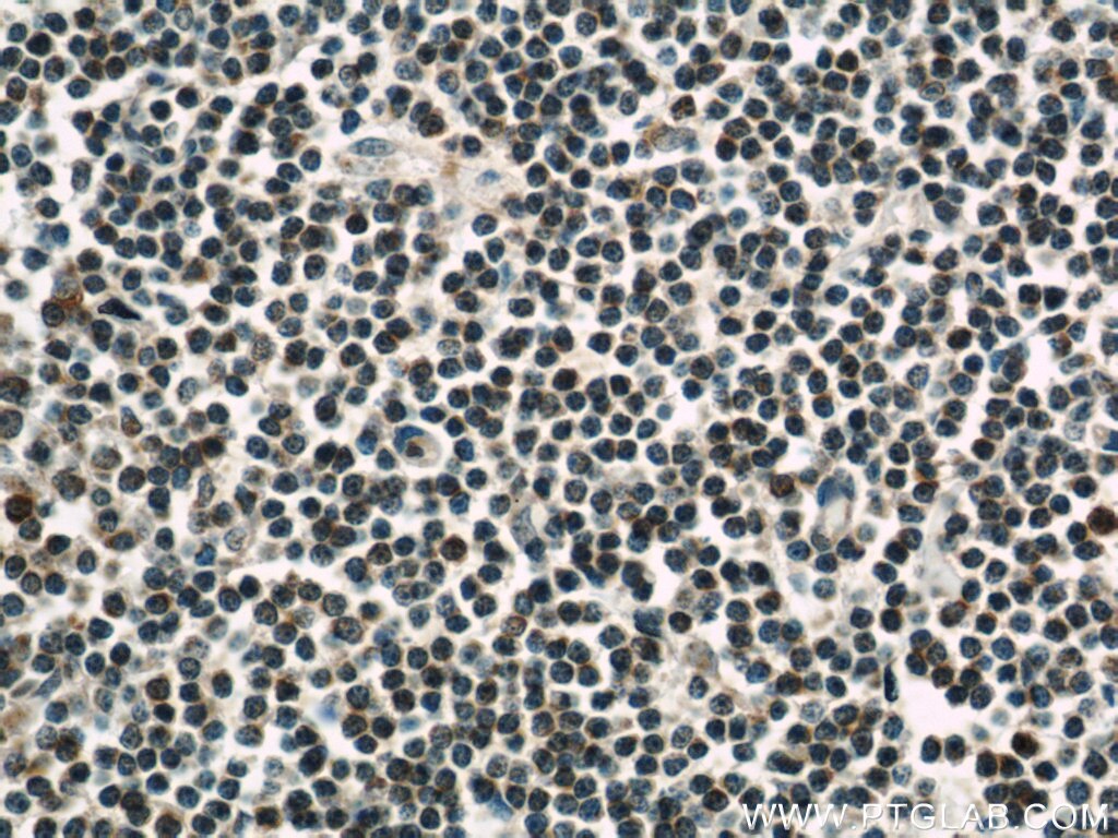 BAX Antibody 50599-2-Ig | Proteintech