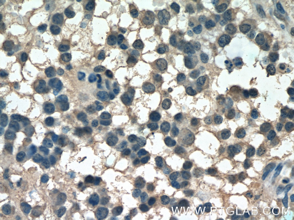 BCRP/ABCG2 Antibody 10051-1-AP | Proteintech