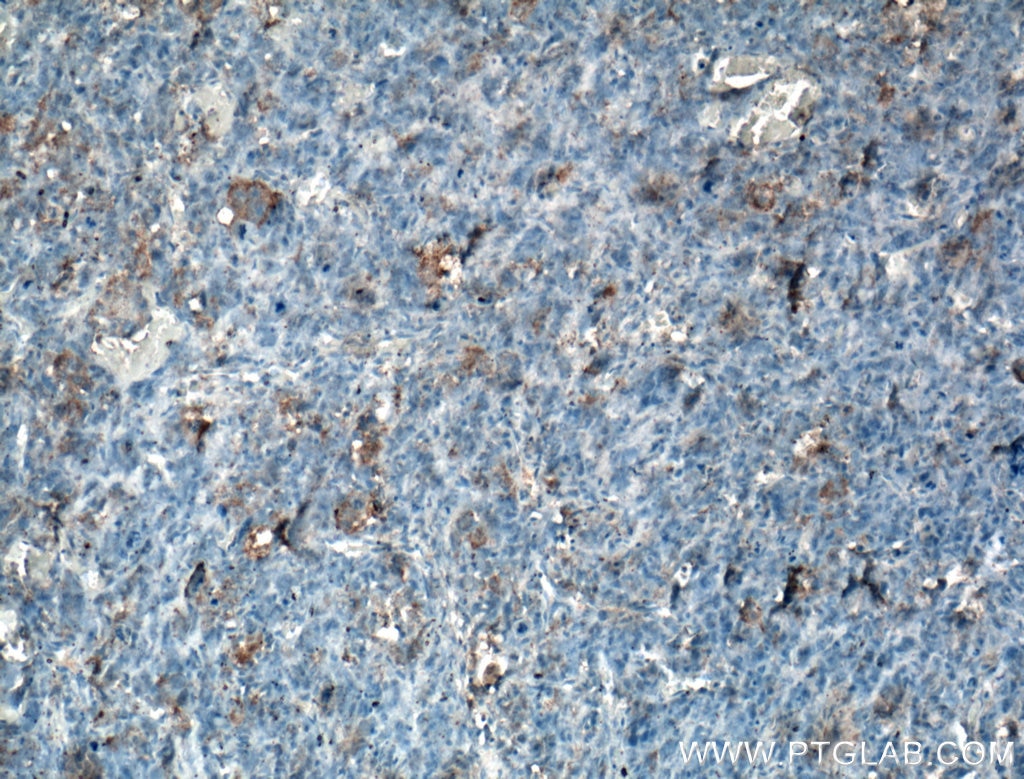 Osteocalcin Antibody 20277-1-AP | Proteintech