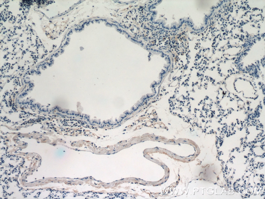 Osteocalcin Antibody 20277-1-AP | Proteintech