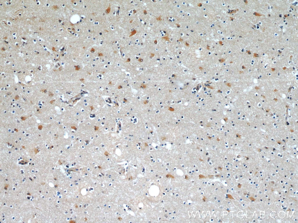 C9orf72 antibody (66140-1-Ig) | Proteintech