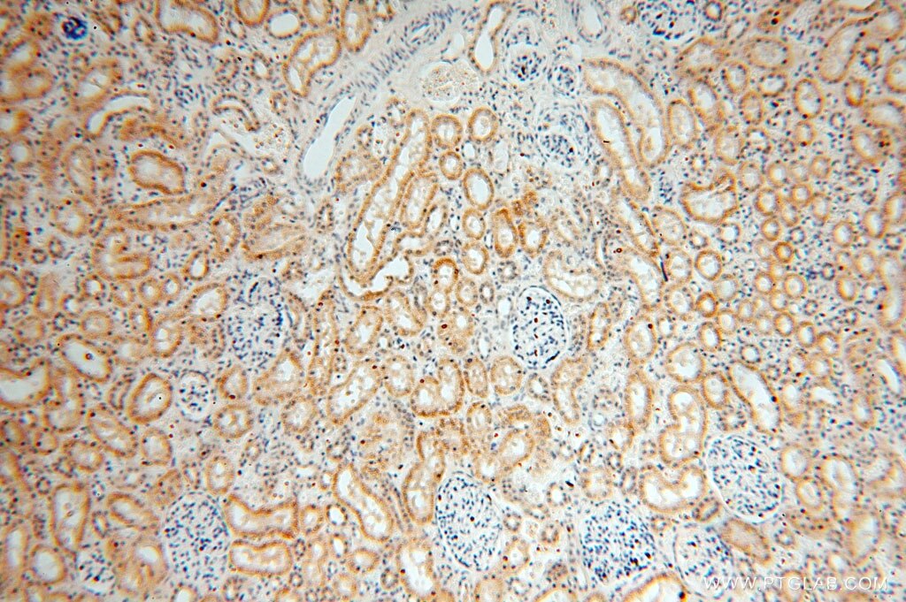CA13 antibody (16696-1-AP) | Proteintech