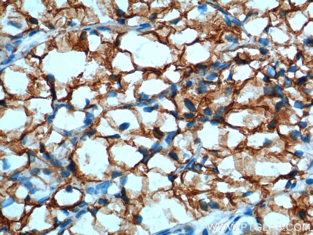 CA9 Antibody 11443-1-AP | Proteintech