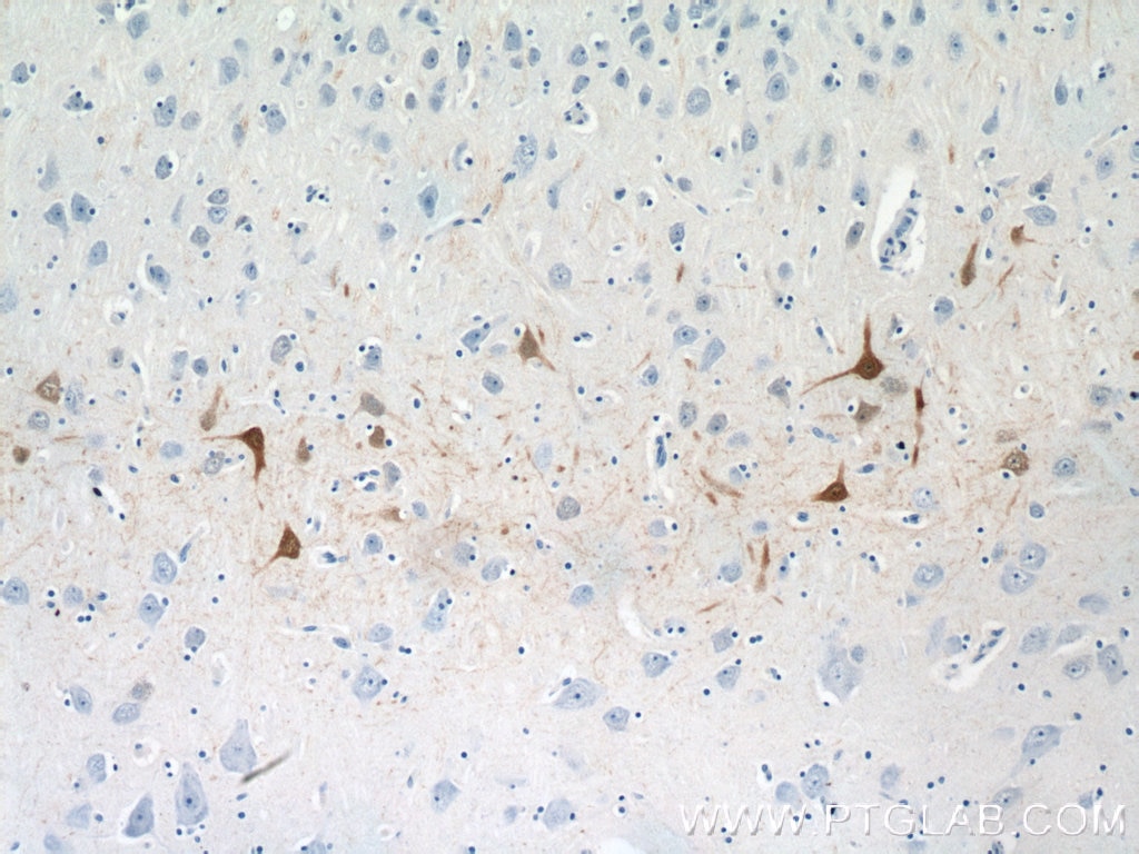 Calbindin-D28k antibody (14479-1-AP) | Proteintech