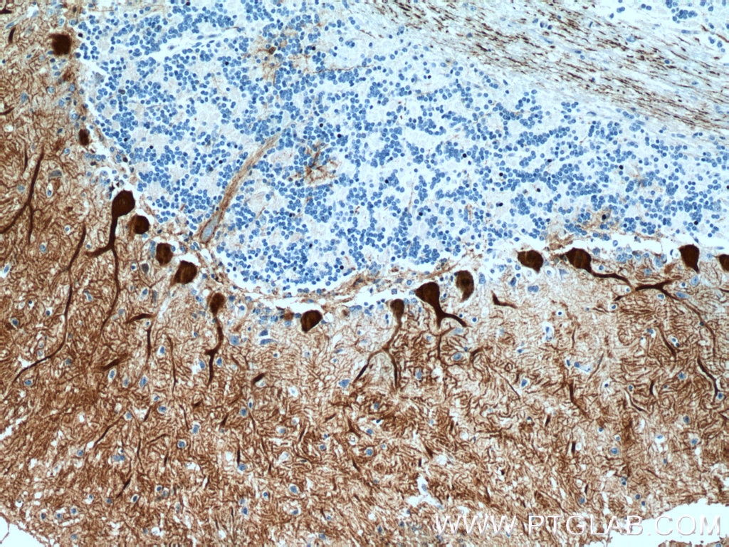 Calbindin-D28k Antibody 14479-1-AP | Proteintech