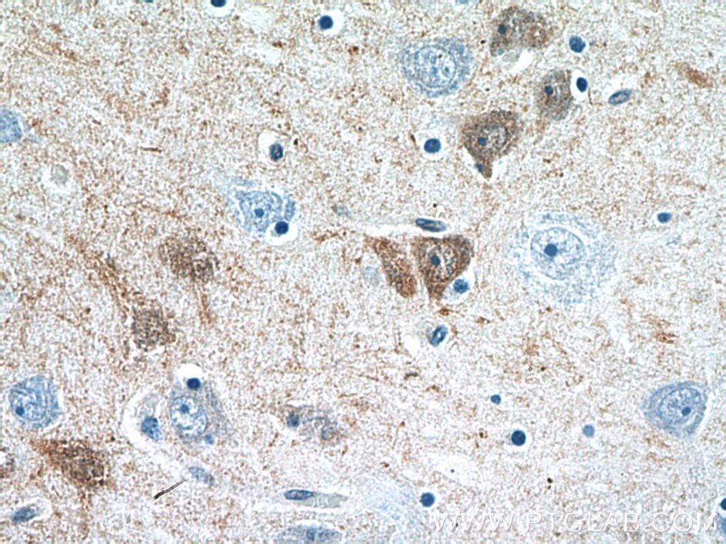 Calretinin antibody (12278-1-AP) | Proteintech
