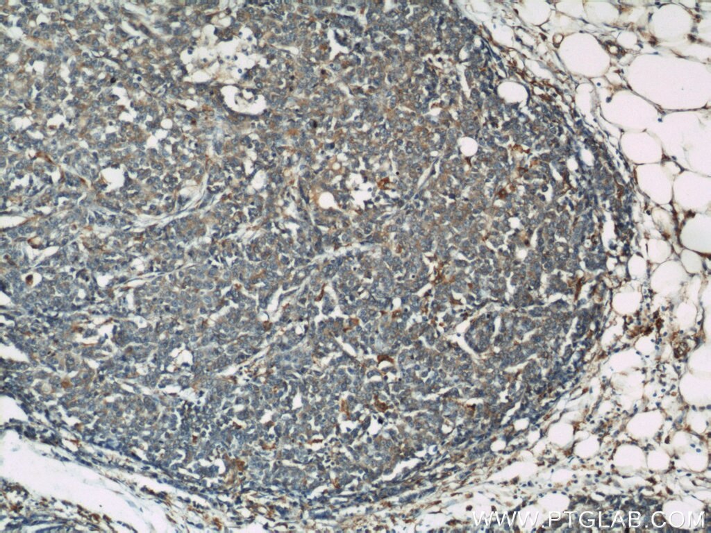 calreticulin Antibody 10292-1-AP | Proteintech