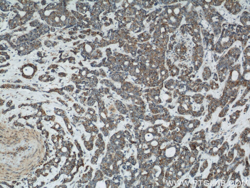 Calnexin Antibody 10427-2-AP | Proteintech