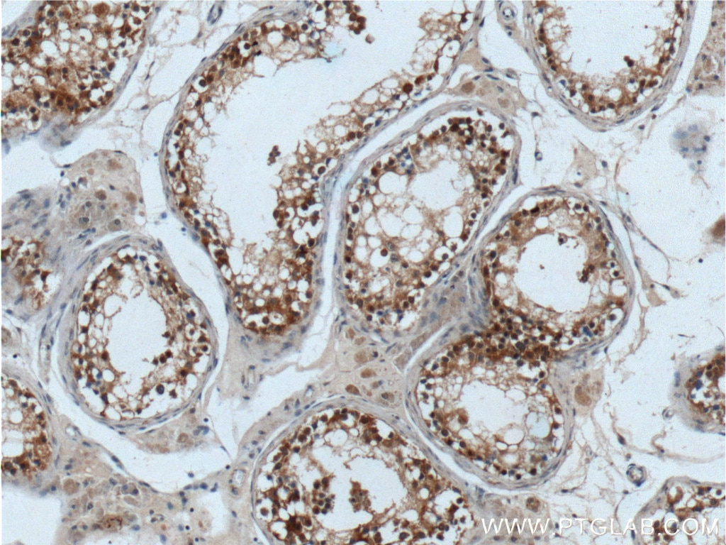 Cyclin E2 Antibody 11935-1-AP | Proteintech