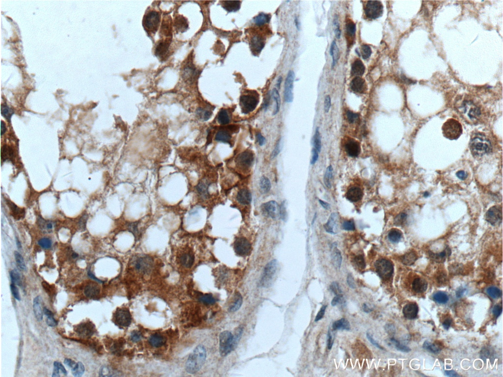 Cyclin E2 Antibody 11935-1-AP | Proteintech