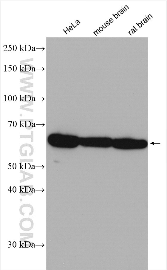 CCT3 antibody (10571-1-AP) | Proteintech