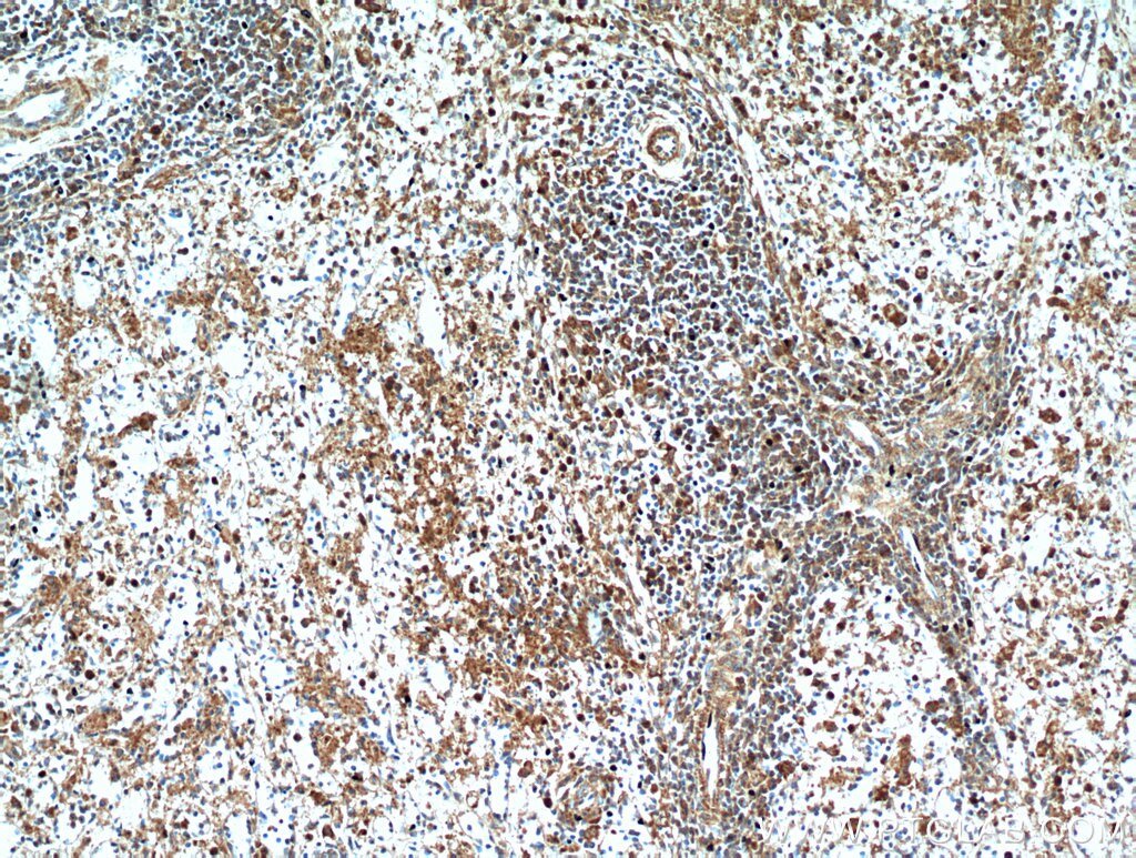 CD11B/Integrin alpha M Antibody 20991-1-AP | Proteintech