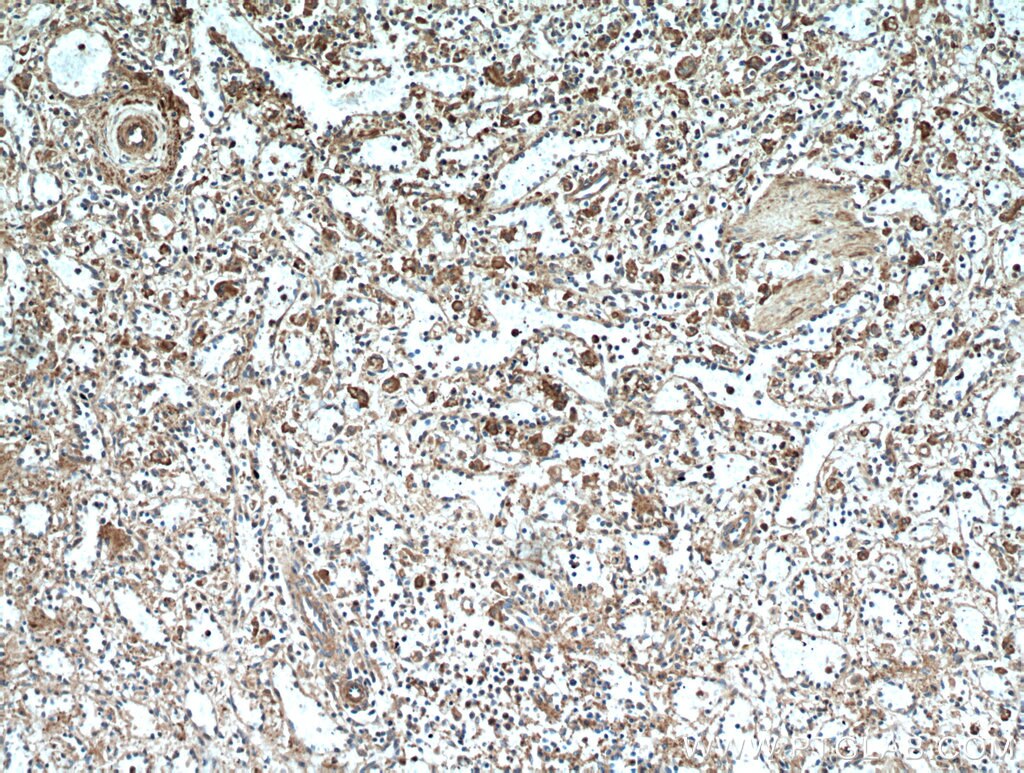 CD11B/Integrin alpha M Antibody 20991-1-AP | Proteintech
