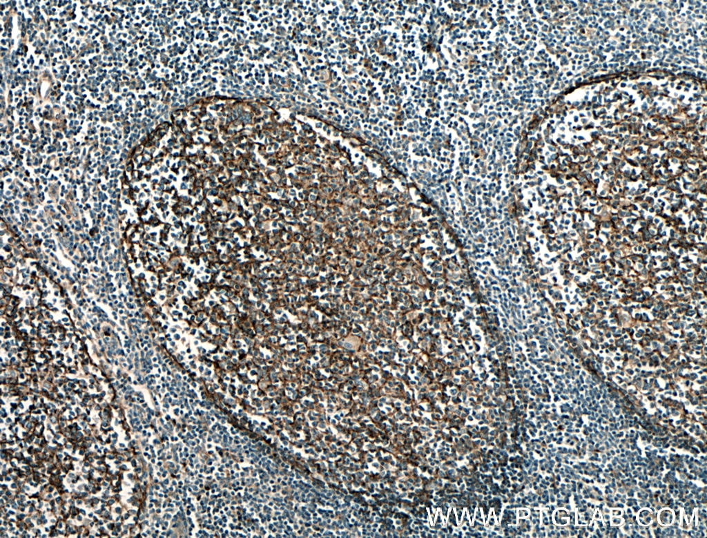 CD11B/Integrin Alpha M antibody (66519-1-Ig) | Proteintech