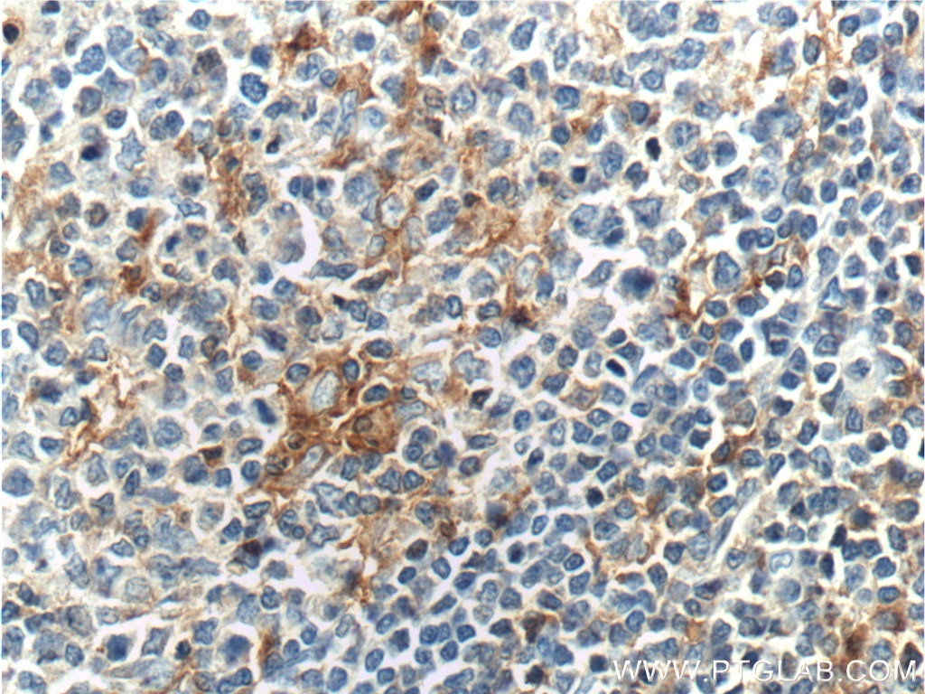 CD18 antibody (10554-1-AP) | Proteintech