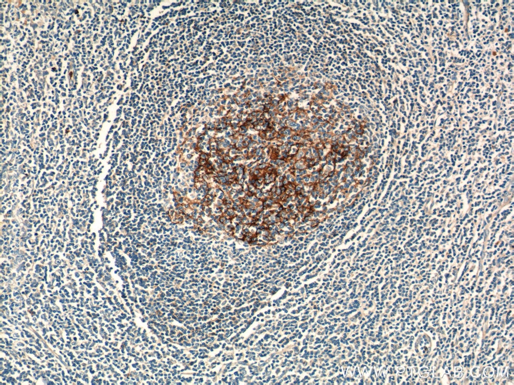 CD23 antibody (18642-1-AP) | Proteintech