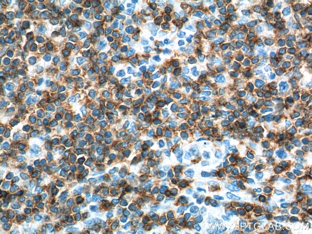 CD247 Antibody 12837-2-AP | Proteintech