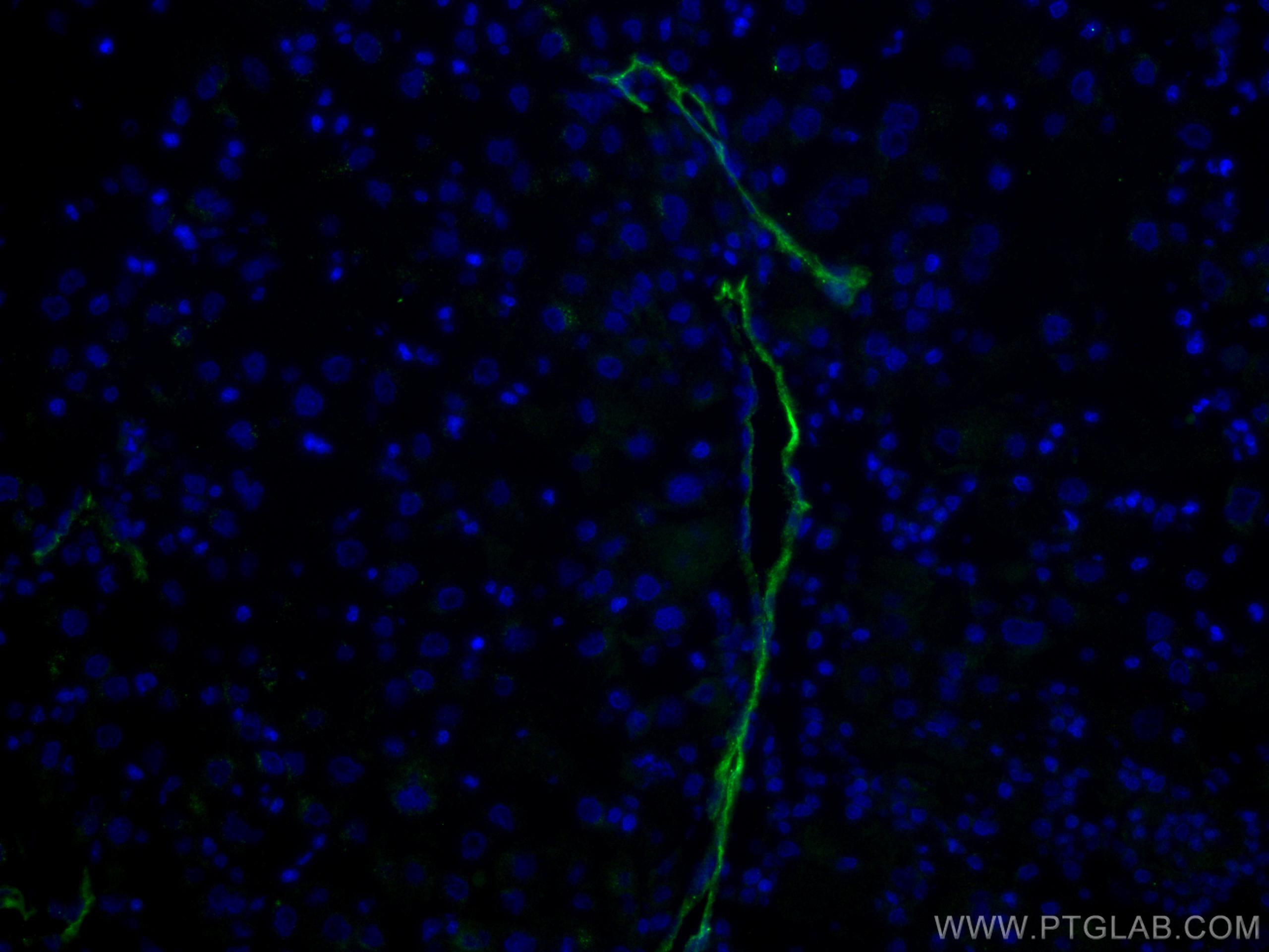 CD34 Antibody 14486-1-AP | Proteintech