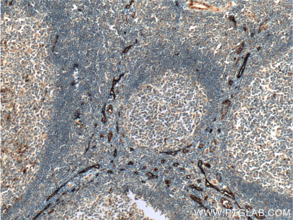 CD34 Antibody 14486-1-AP | Proteintech