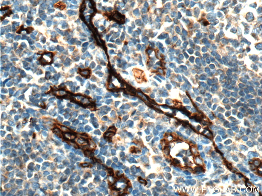CD34 Antibody 14486-1-AP | Proteintech
