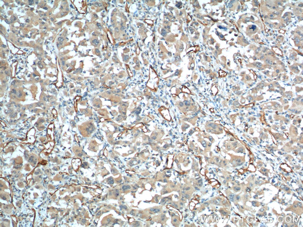 CD34 Antibody 60180-1-Ig | Proteintech