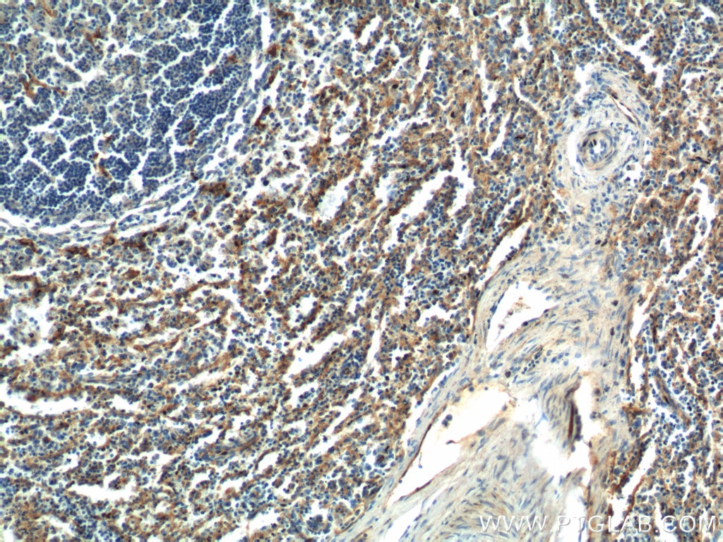 CD36 Antibody 18836-1-AP | Proteintech