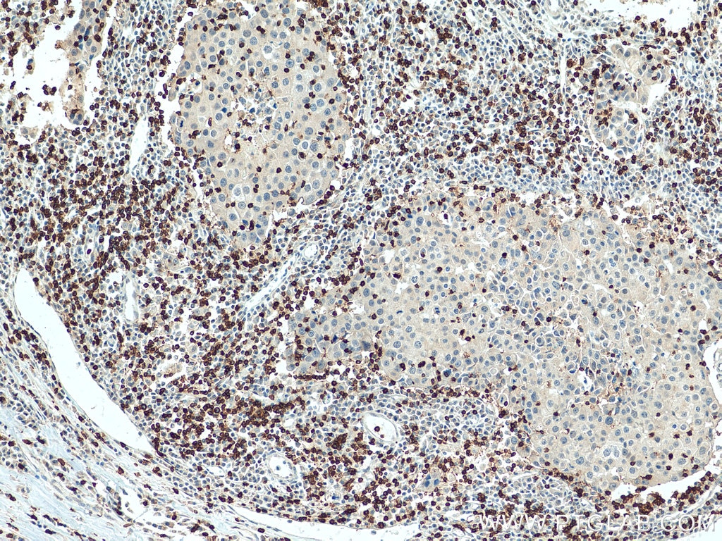 CD3 antibody (17617-1-AP) | Proteintech