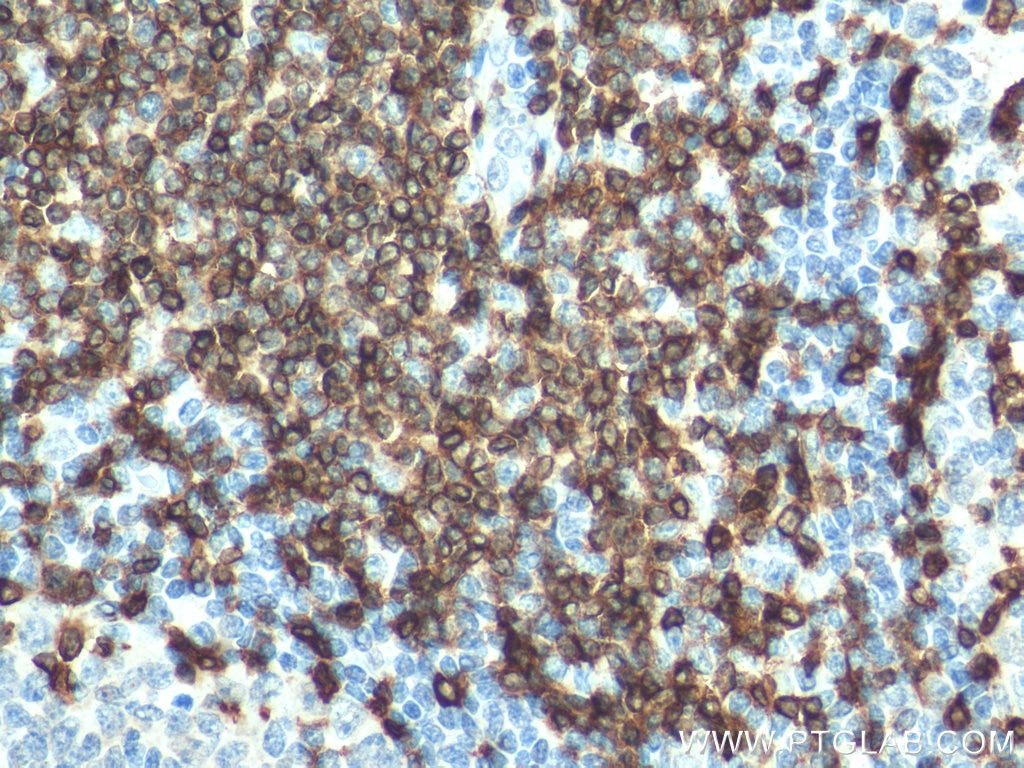 CD3 antibody (17617-1-AP) | Proteintech