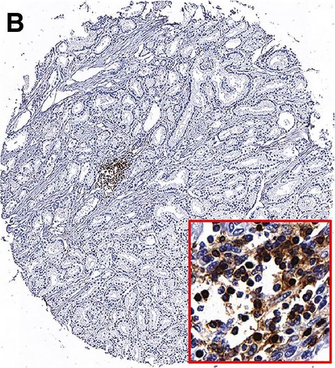 CD4 Antibody 19068-1-AP | Proteintech