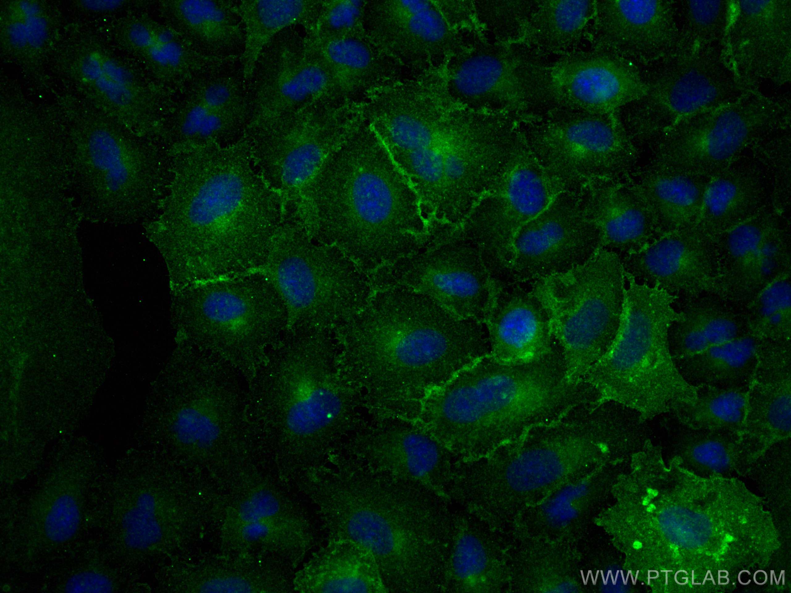 CD55 antibody (26580-1-AP) | Proteintech