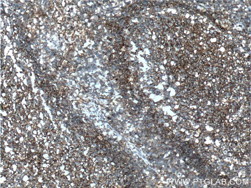 CD55 antibody (26580-1-AP) | Proteintech