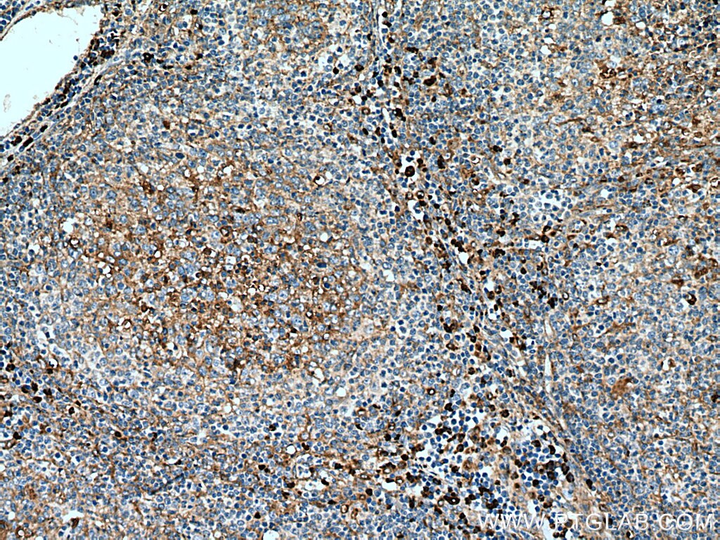 CD63 antibody (25682-1-AP) | Proteintech
