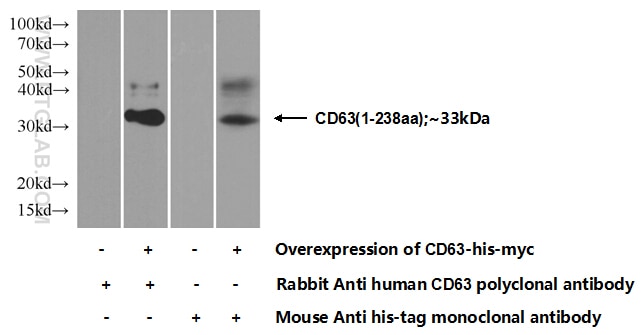 CD63 Antibody 25682-1-AP | Proteintech