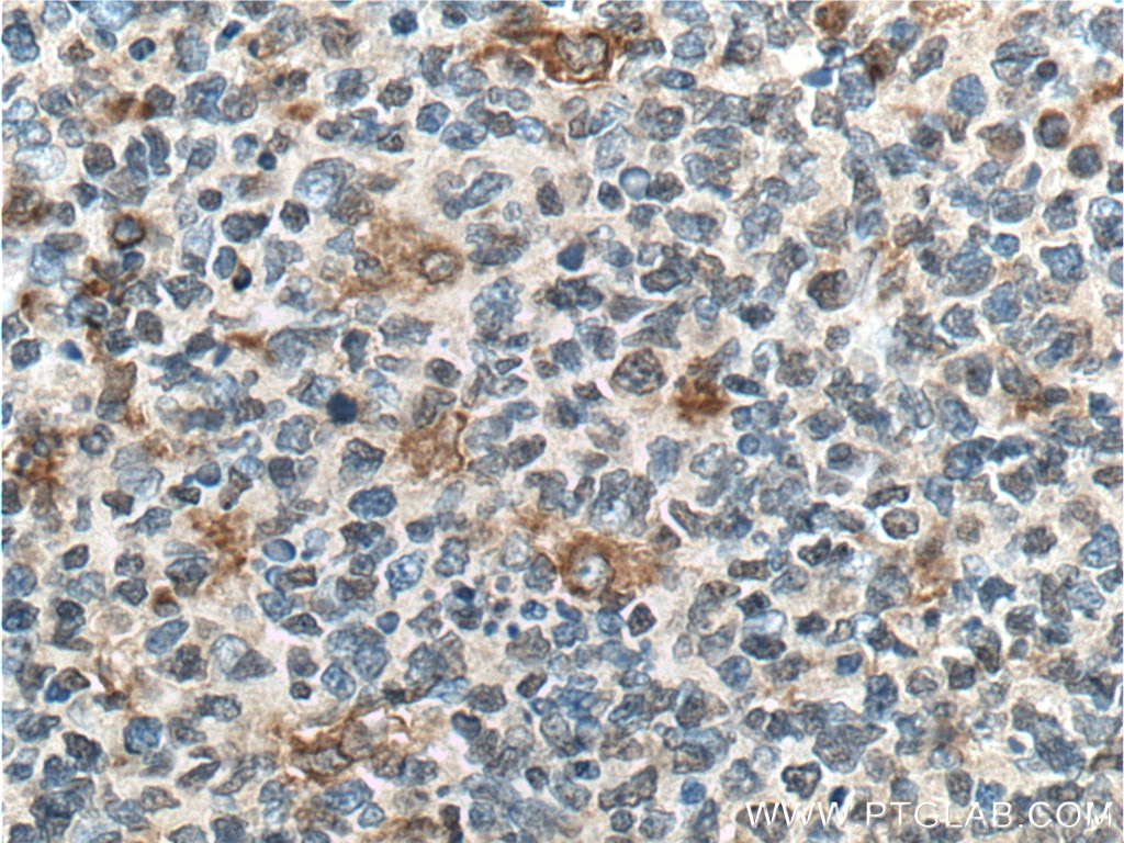 CD68 Antibody 66231-1-Ig | Proteintech