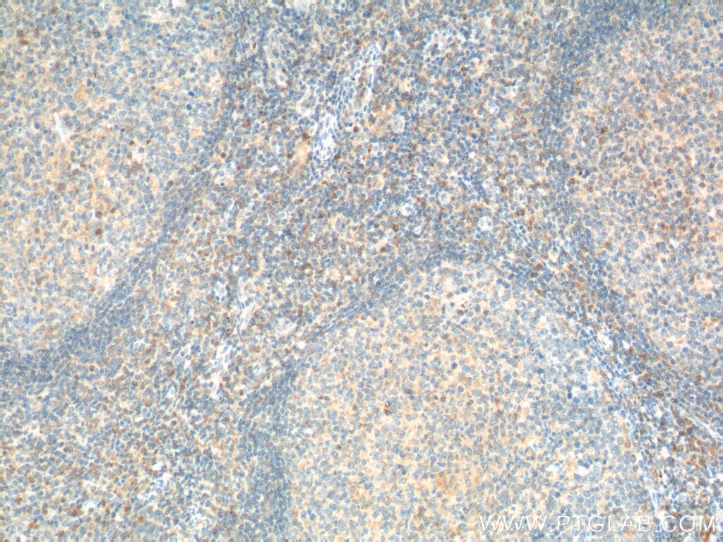 CD86 Antibody 13395-1-AP | Proteintech