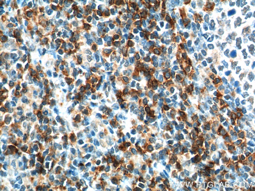 CD8a antibody (17335-1-AP) | Proteintech