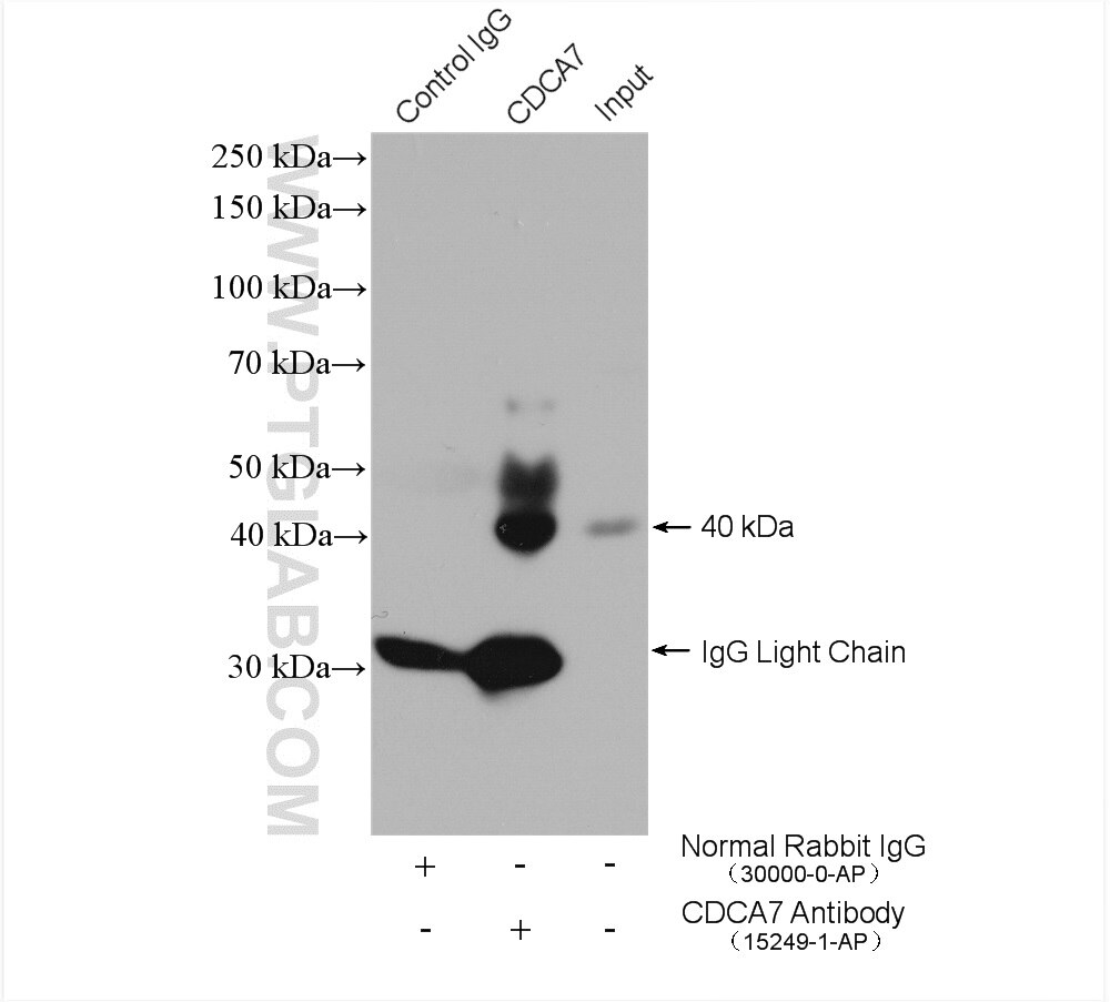 CDCA7 Antibody 15249-1-AP | Proteintech